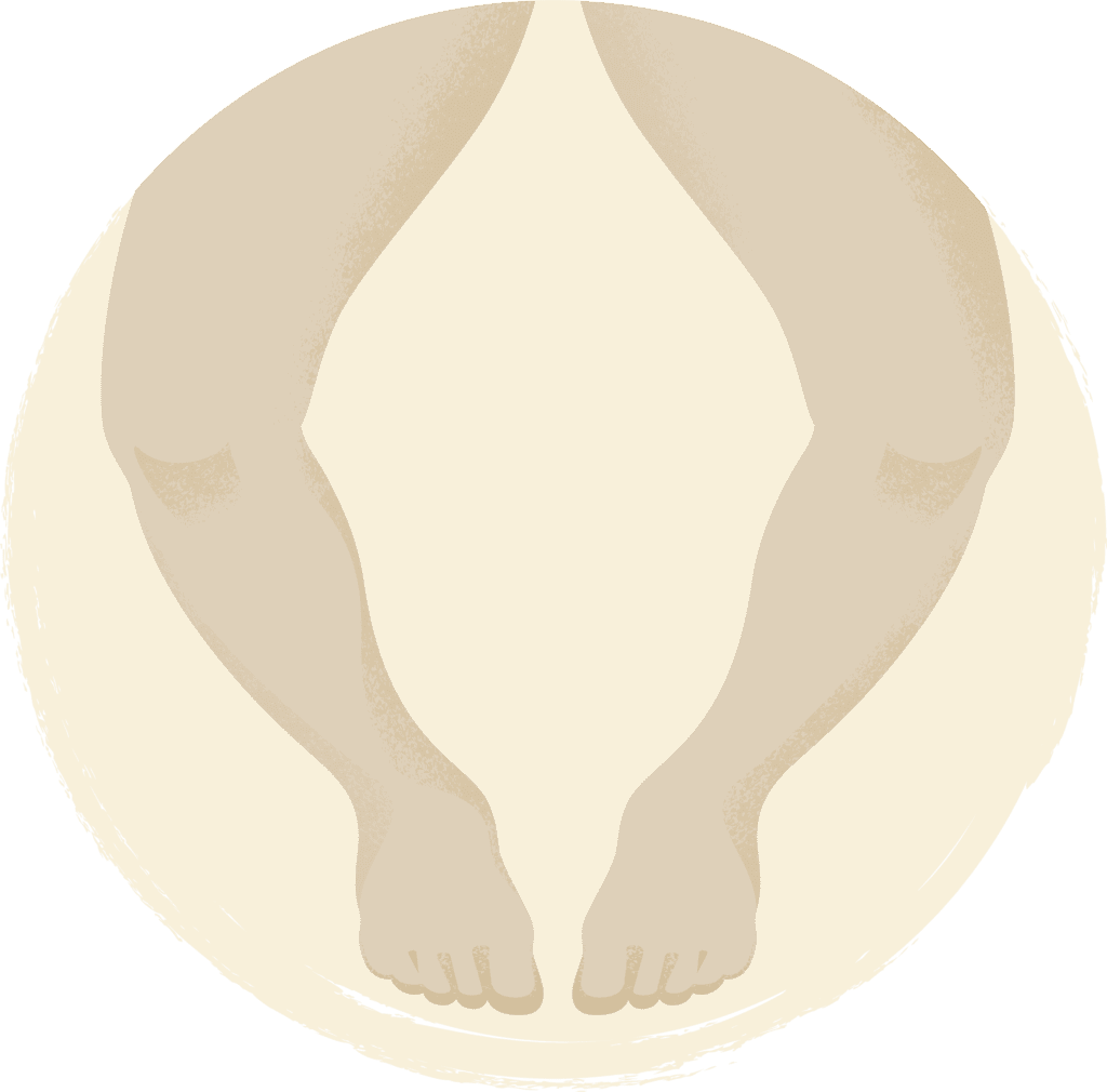 Bowed Legs - CURE Zambia